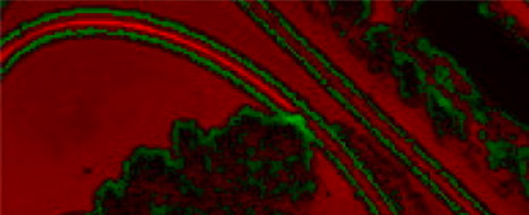 Tensor Cuts A Simultaneous Multi Type Feature Extractor And Classifier And Its Application To